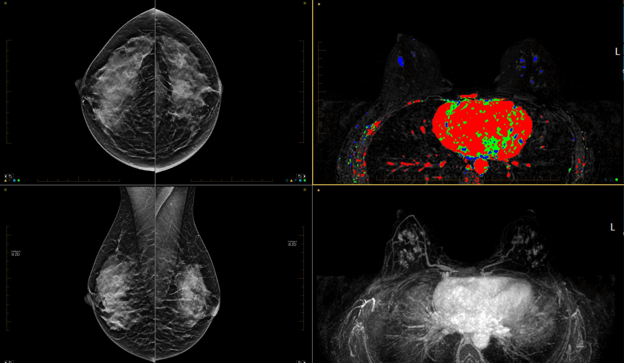Mammography Archives • Diversified Radiology
